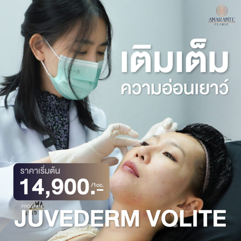 รวมข้อมูล Juvederm Volite เหมาะกับใคร? ราคาเท่าไหร่?