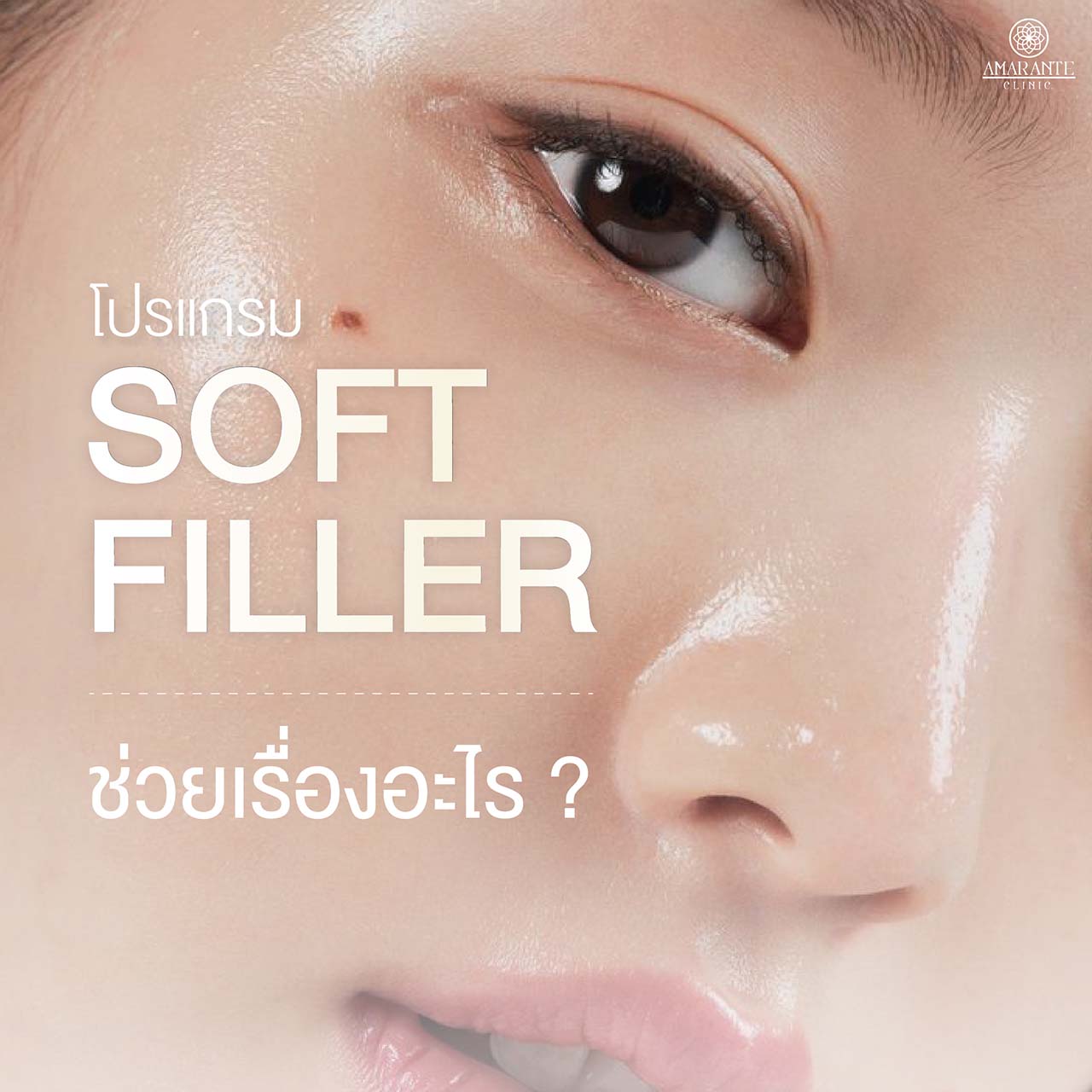 Soft Filler คืออะไร ช่วยอะไรบ้าง รู้ไว้ก่อนตกเป็นเหยื่อการตลาด